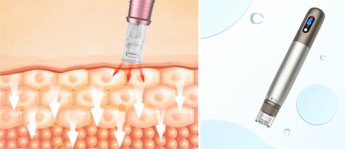 How to Use Microneedling Dermapen? - Adelyn Cline
